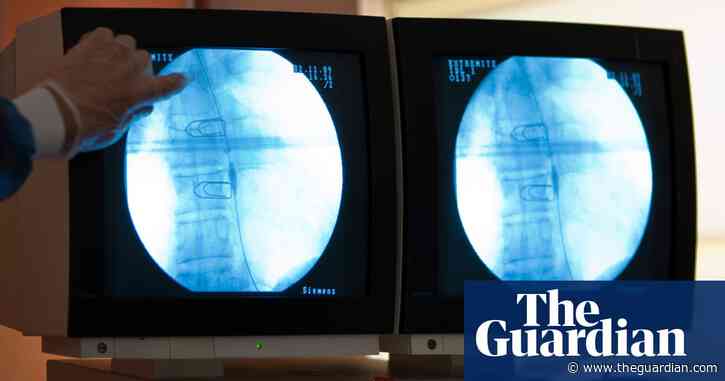 Schamroth window: Simple finger test that 'can reveal cancer' - Health ...