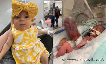 Premature baby born with her intestines OUTSIDE her body defies odds to ...