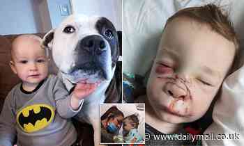 Staffordshire Bull Terrier Cross dog attack: Mother shares how son's ...